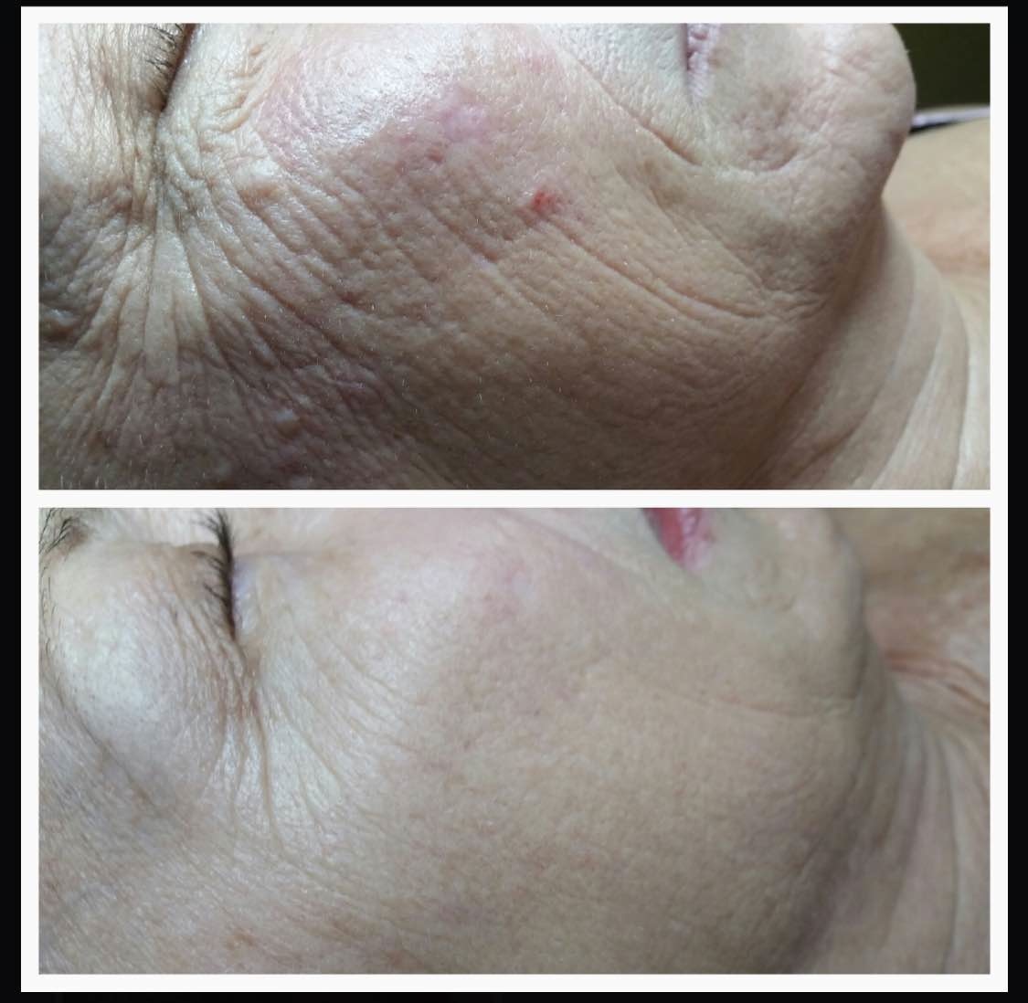 Custom Facials | Solarius Spa